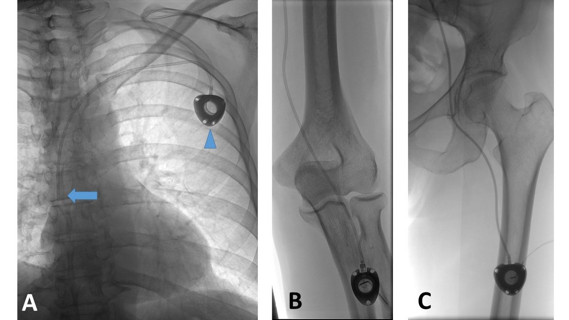 Interventionelle Radiologie | Radiologie | Lübeck | Sana Kliniken AG